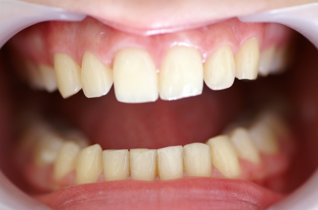 Dental Clinic | Οδοντιατρείο Καστοριά | Υπηρεσίες 2