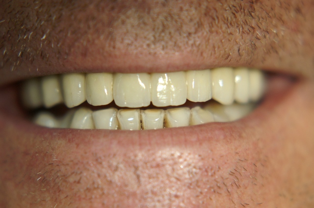Dental Clinic | Οδοντιατρείο Καστοριά | Υπηρεσίες 2