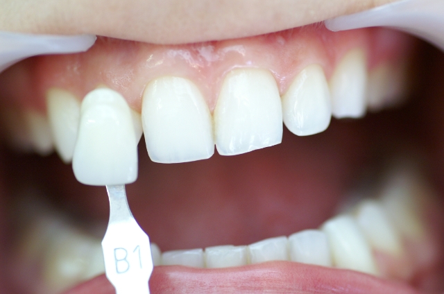 Dental Clinic | Οδοντιατρείο Καστοριά | Υπηρεσίες 2