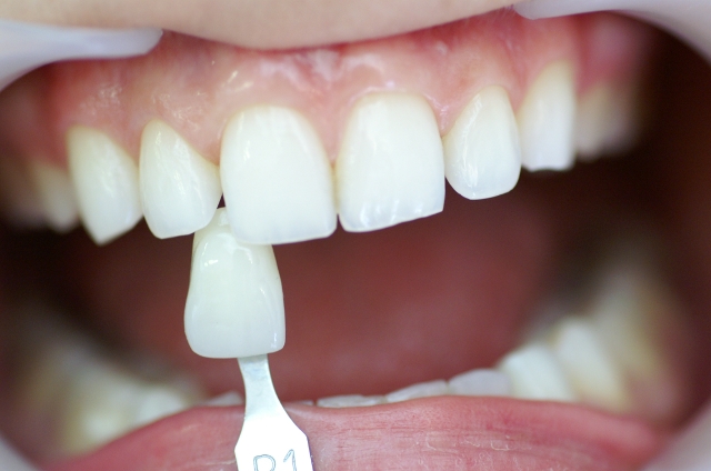 Dental Clinic | Οδοντιατρείο Καστοριά | Υπηρεσίες 2