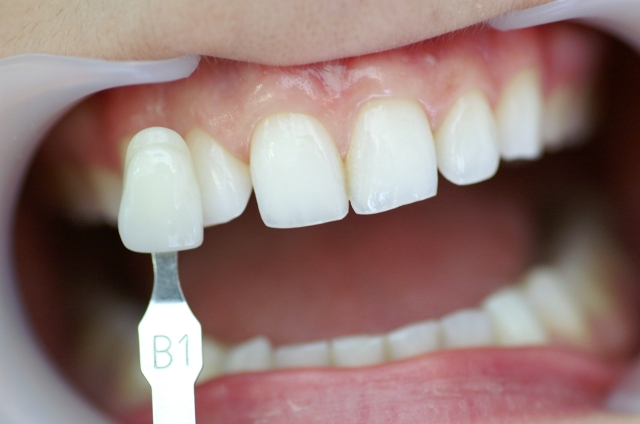 Dental Clinic | Οδοντιατρείο Καστοριά | Υπηρεσίες 2