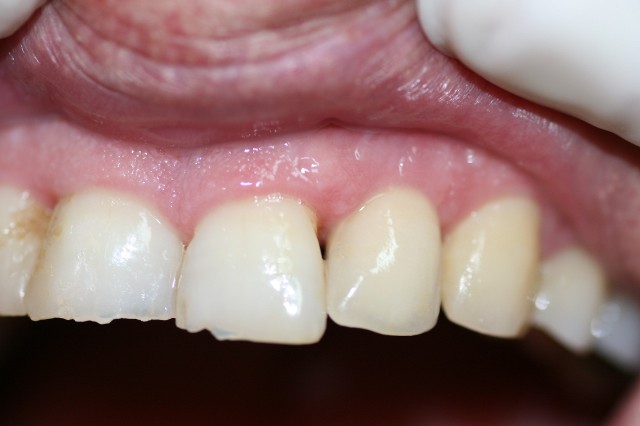 Dental Clinic | Οδοντιατρείο Καστοριά | Υπηρεσίες 2