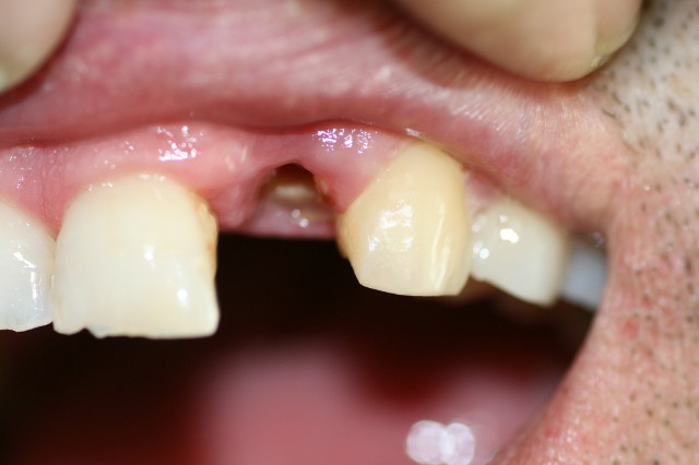 Dental Clinic | Οδοντιατρείο Καστοριά | Υπηρεσίες 2