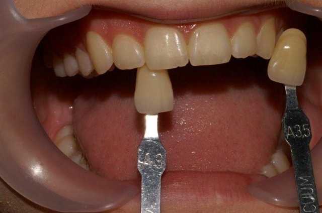 Dental Clinic | Οδοντιατρείο Καστοριά | Υπηρεσίες 2