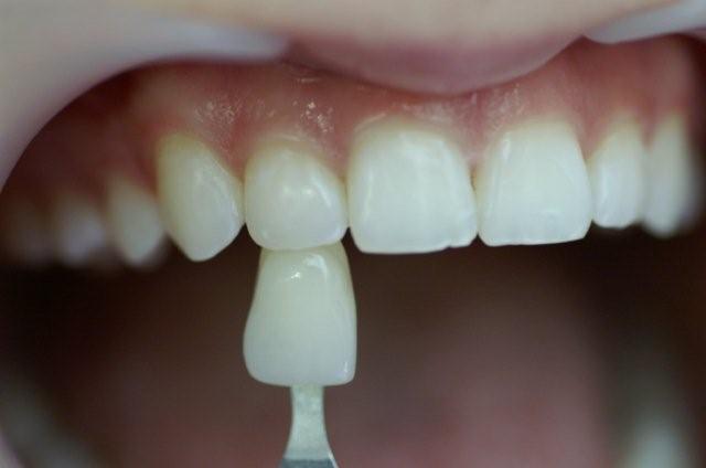 Dental Clinic | Οδοντιατρείο Καστοριά | Υπηρεσίες 2