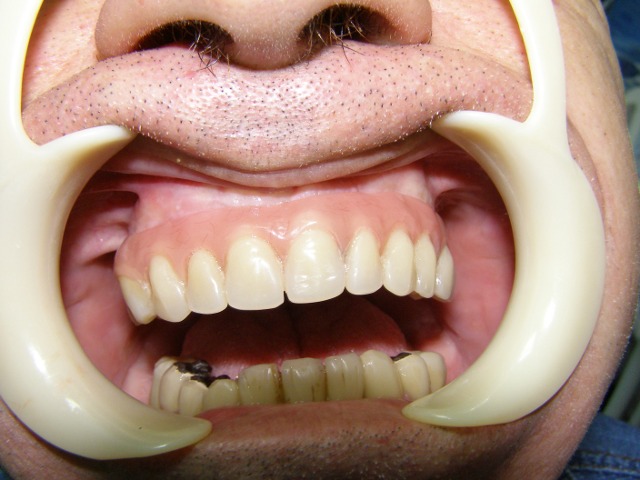 Dental Clinic | Οδοντιατρείο Καστοριά | Υπηρεσίες 2